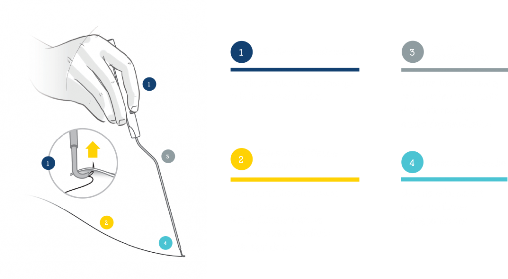 Technology – DuraStat